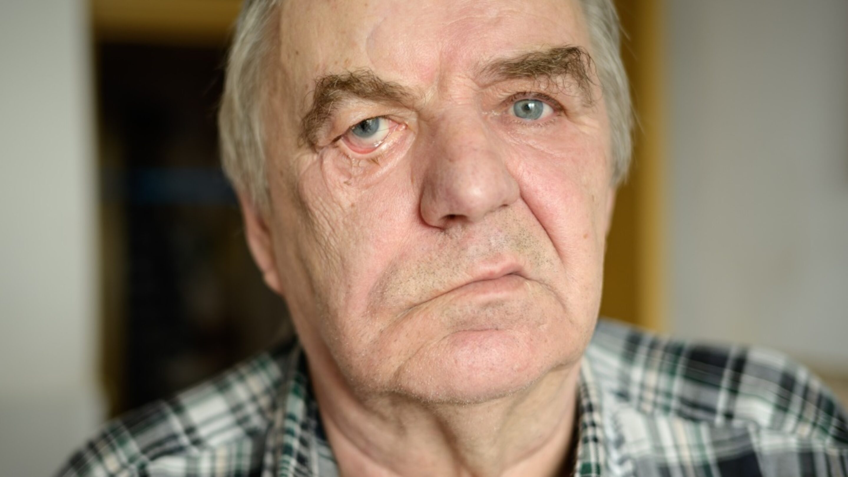 Expertiseteam helpt als aangezichtsverlamming niet over gaat - Amazing Erasmus MC