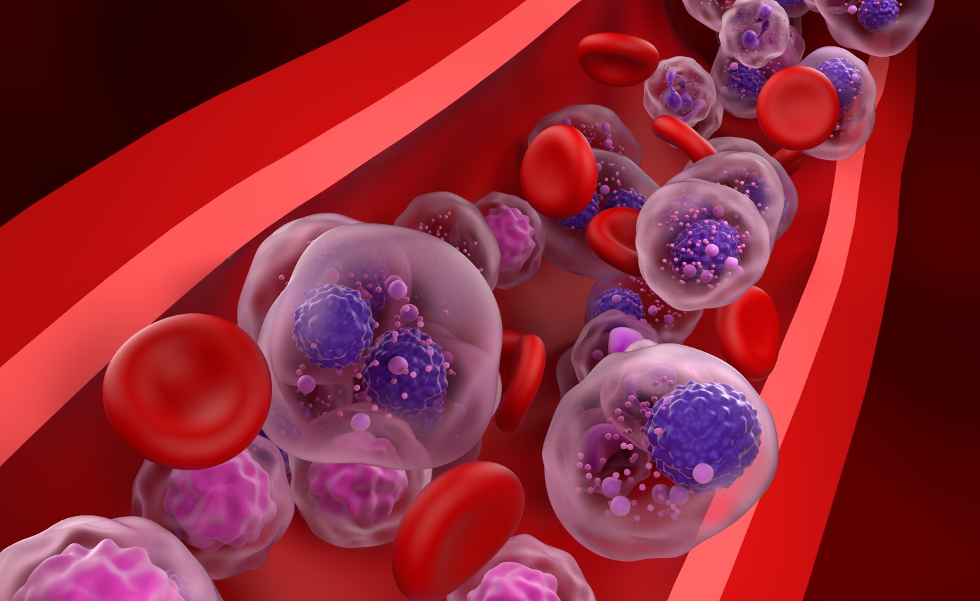 Stap vooruit in behandeling multipel myeloom - Amazing Erasmus MC