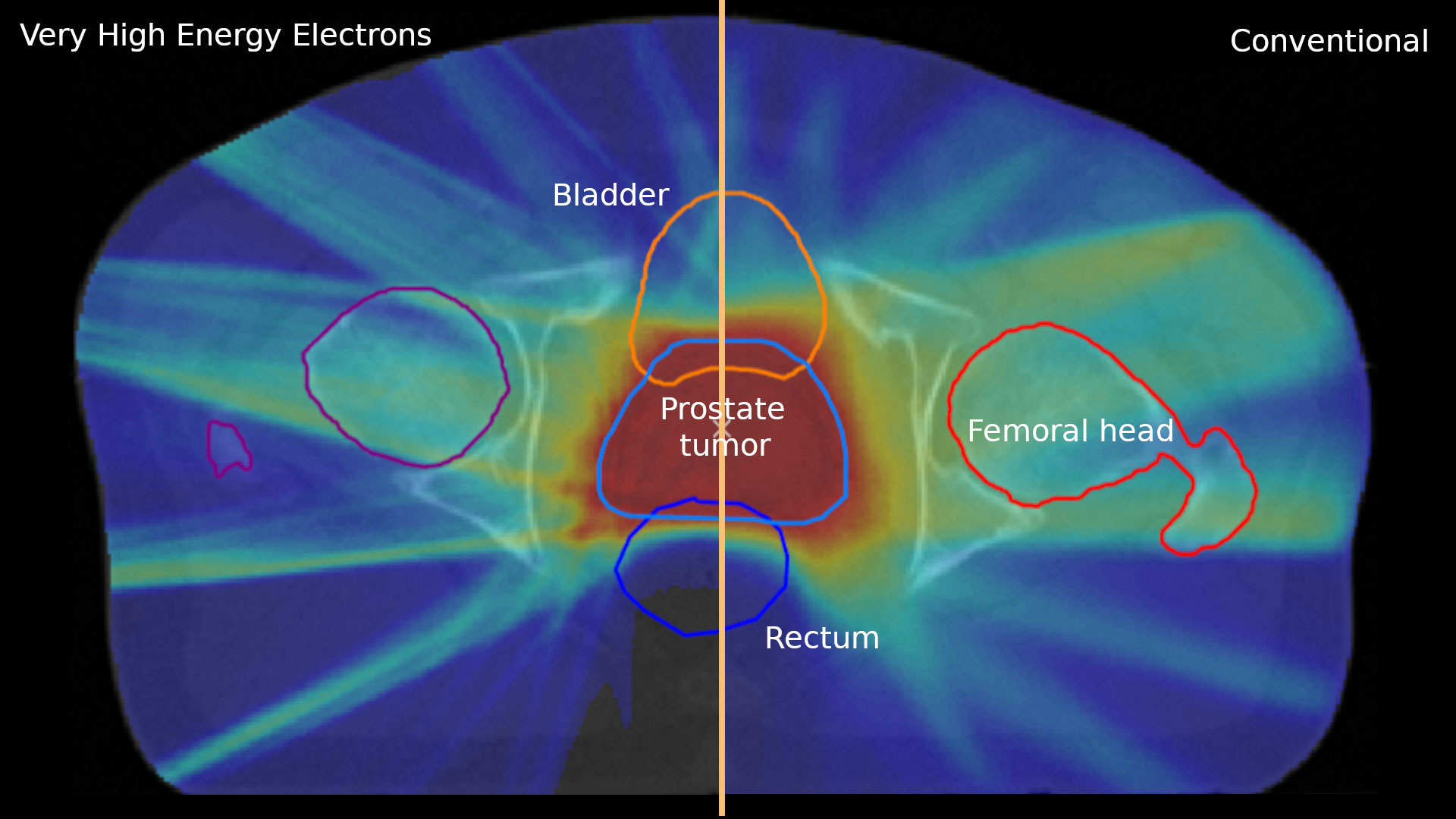 Ruim 1 miljoen euro voor nieuwe vorm van bestraling - Amazing Erasmus MC