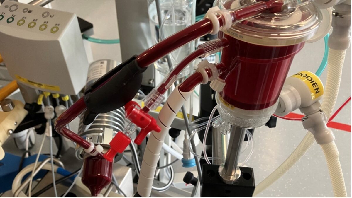 ECMO gaf al duizend zieke kinderen adempauze - Amazing Erasmus MC